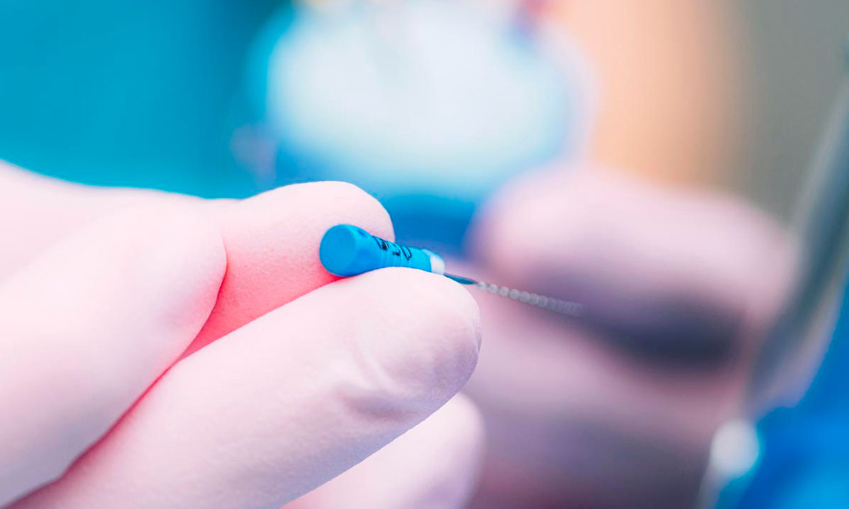 Root Canal and Crown: How Are They Different? | Desert Lake Family ...